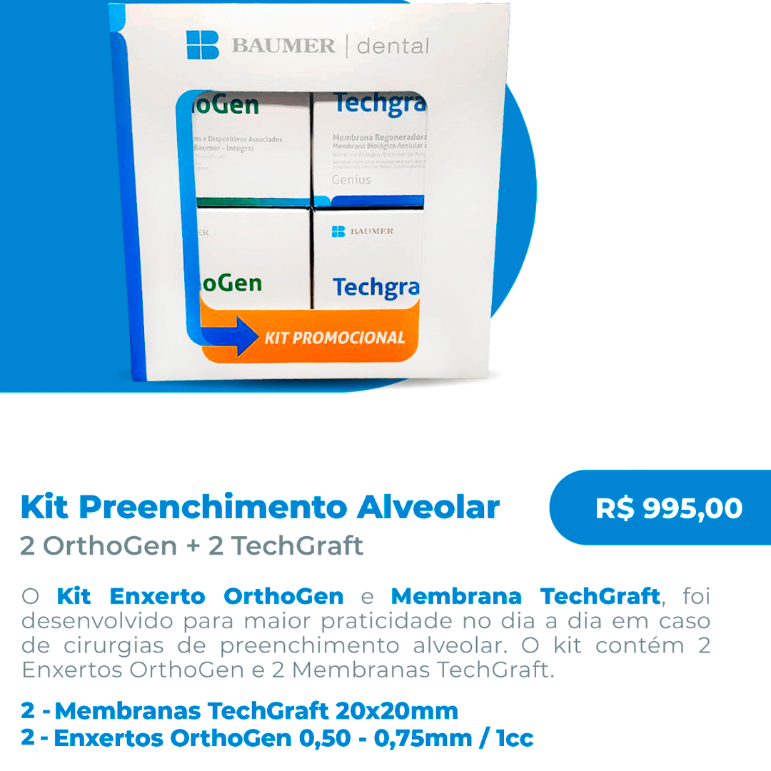 Kit Preenchimento Alveolar - 2 OrthoGen + 2 TechGraft - Genius Digital ...